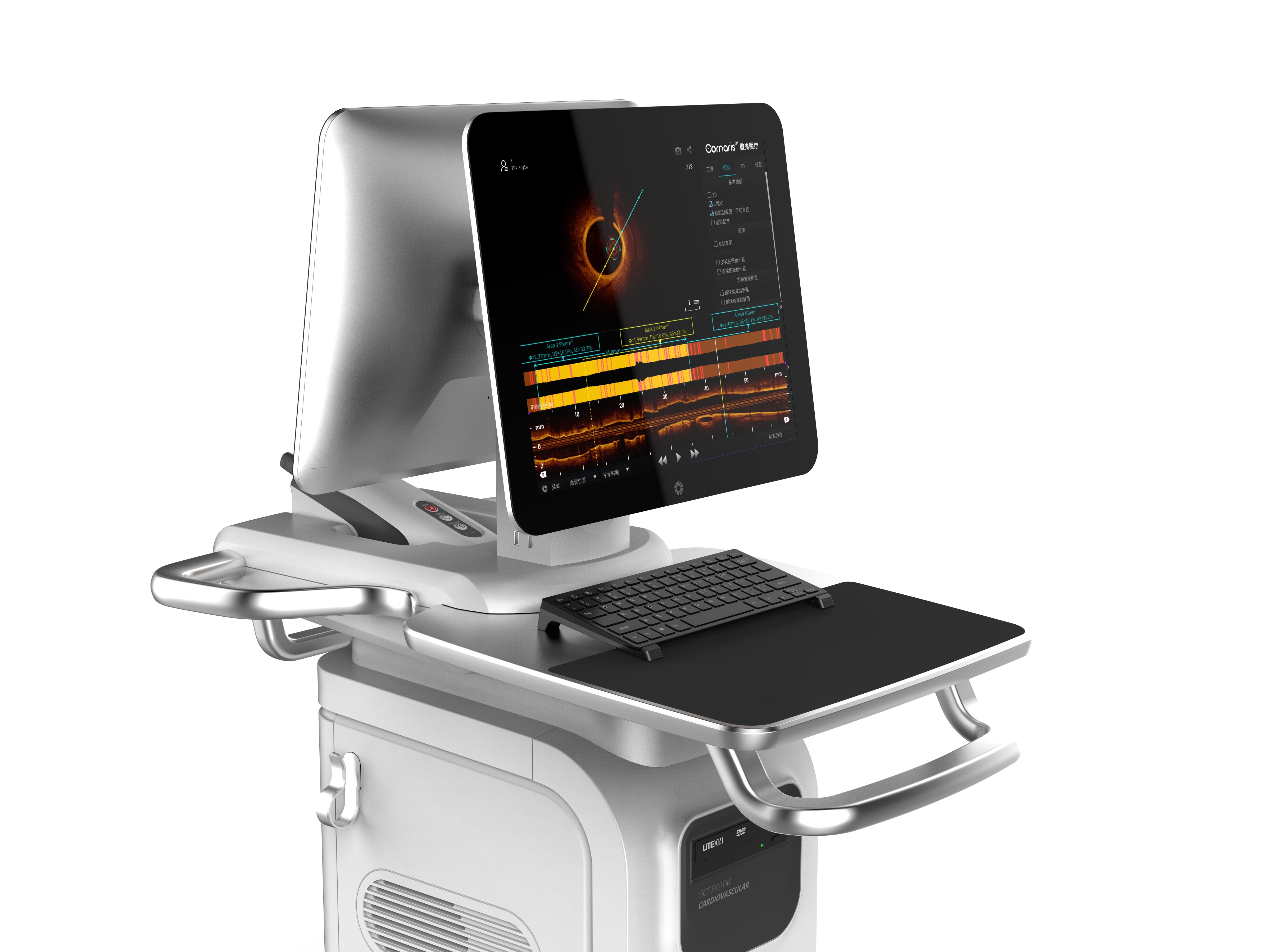 心血管OCT（Cornaris Intravascular Imaging System）_威克索设计-站酷ZCOOL