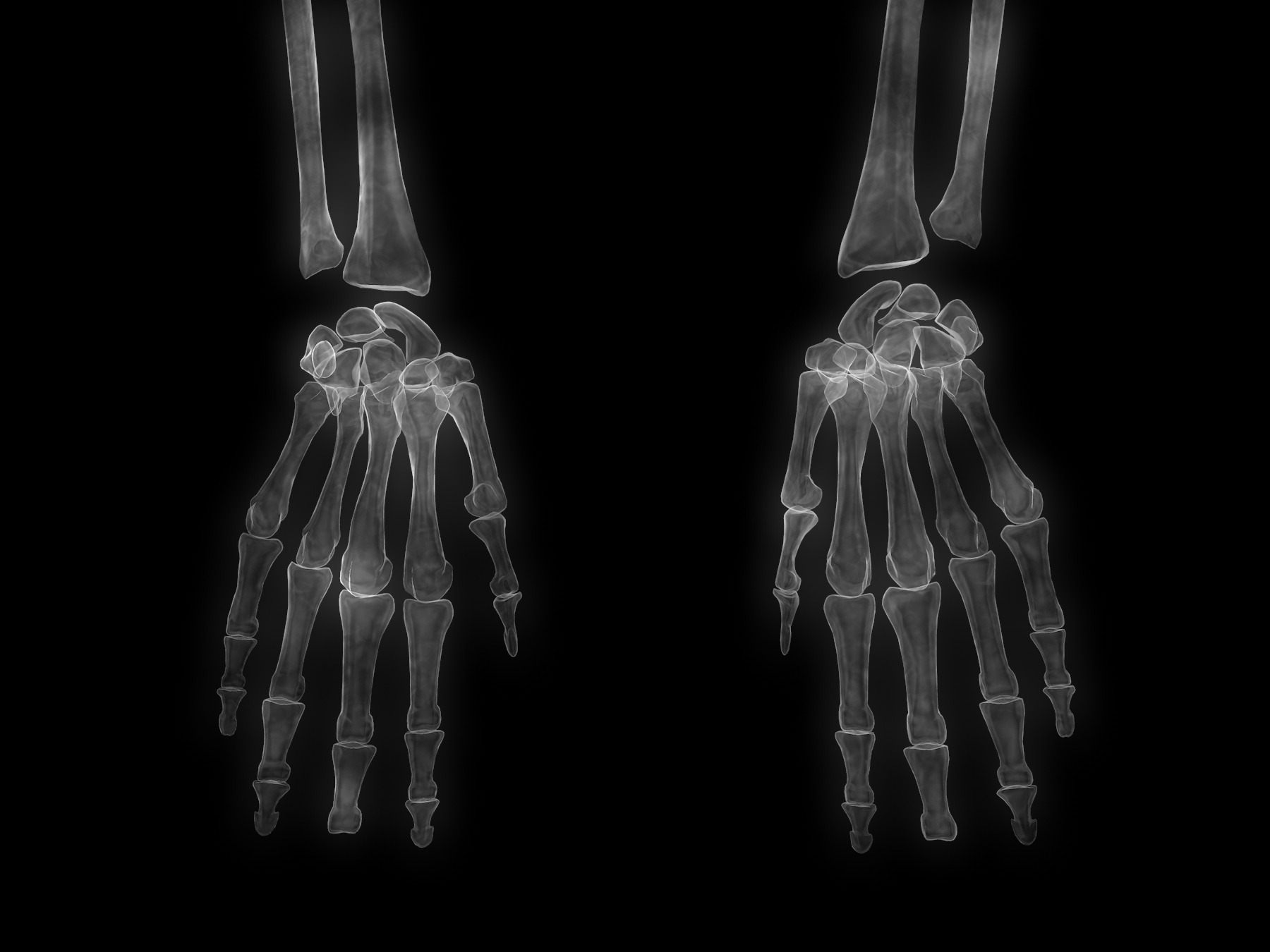 医学 X光 Xray 射线 CT扫描 影像 机场安检 3d三维全息_AD1569-站酷ZCOOL