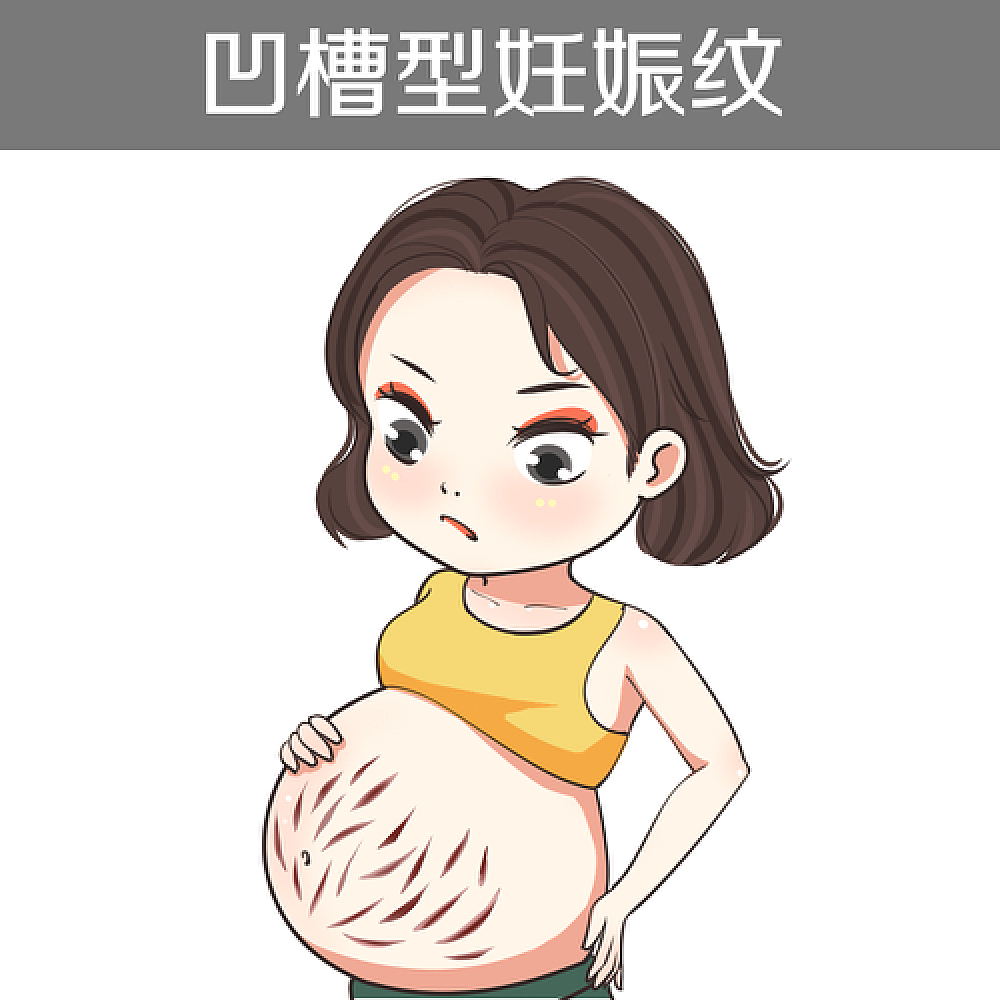 妊娠纹类型没事画画哦 站酷zcool