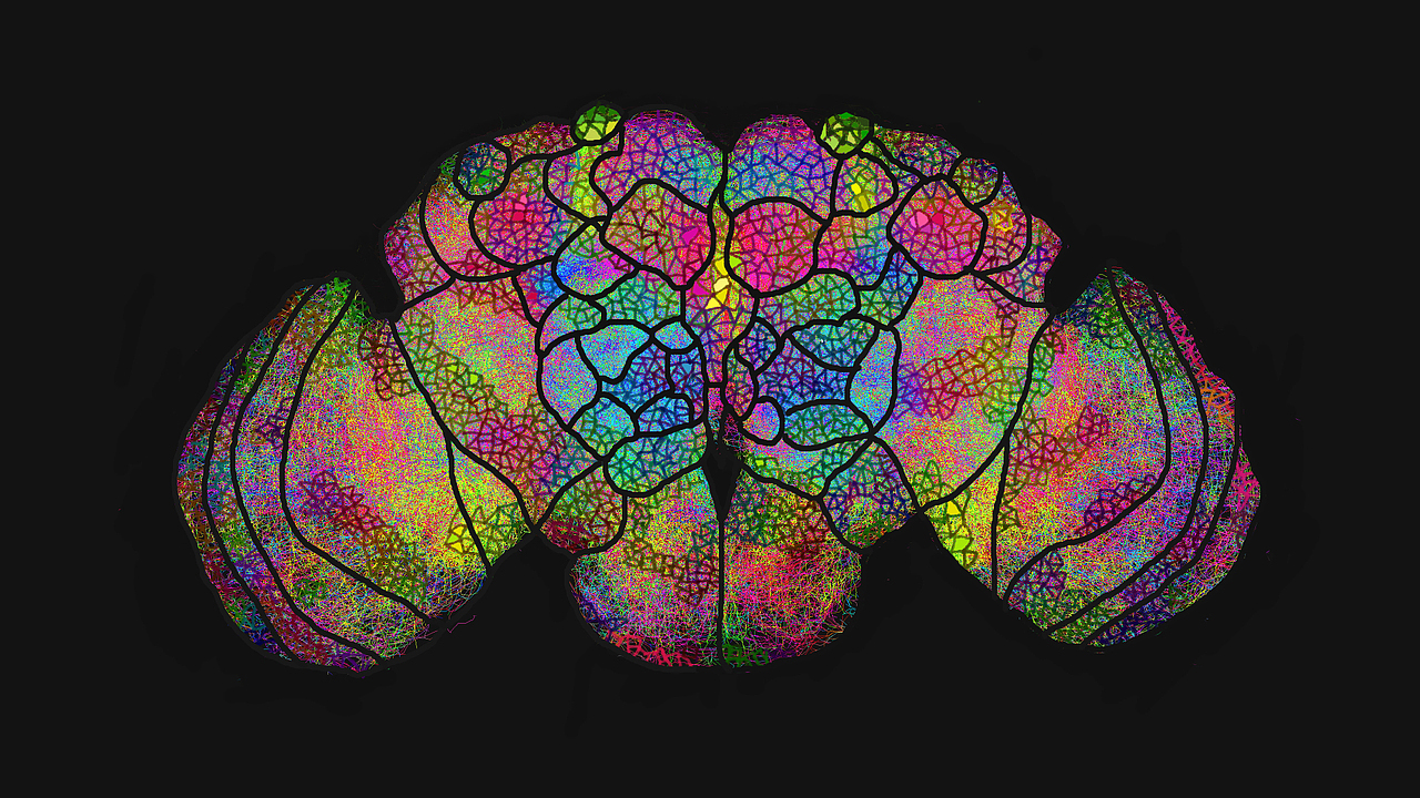 Fly Brain|Graphic Design|Poster|swallowwly_Original作品-站酷ZCOOL