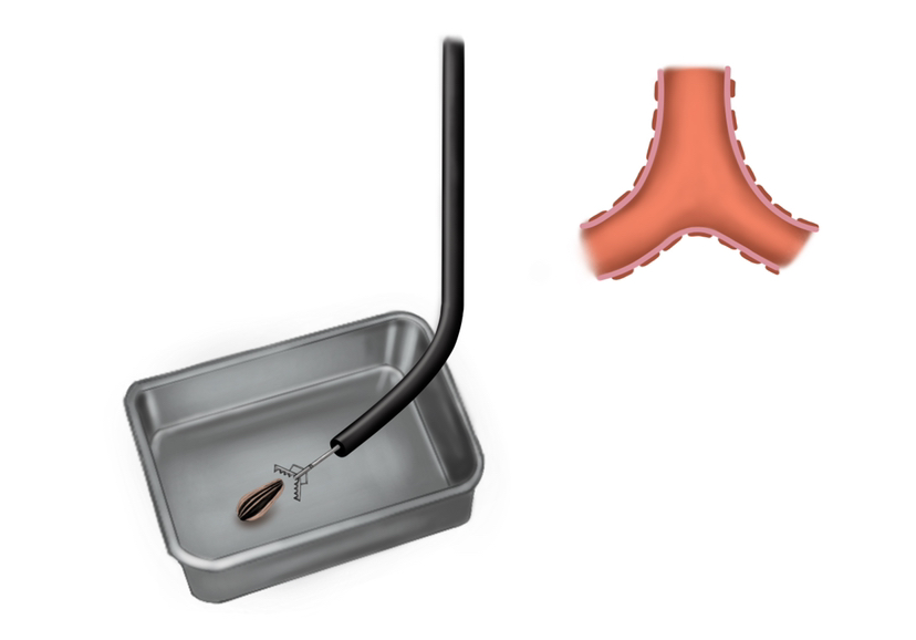 气管镜取异物法（3）_琦琦xue-站酷ZCOOL