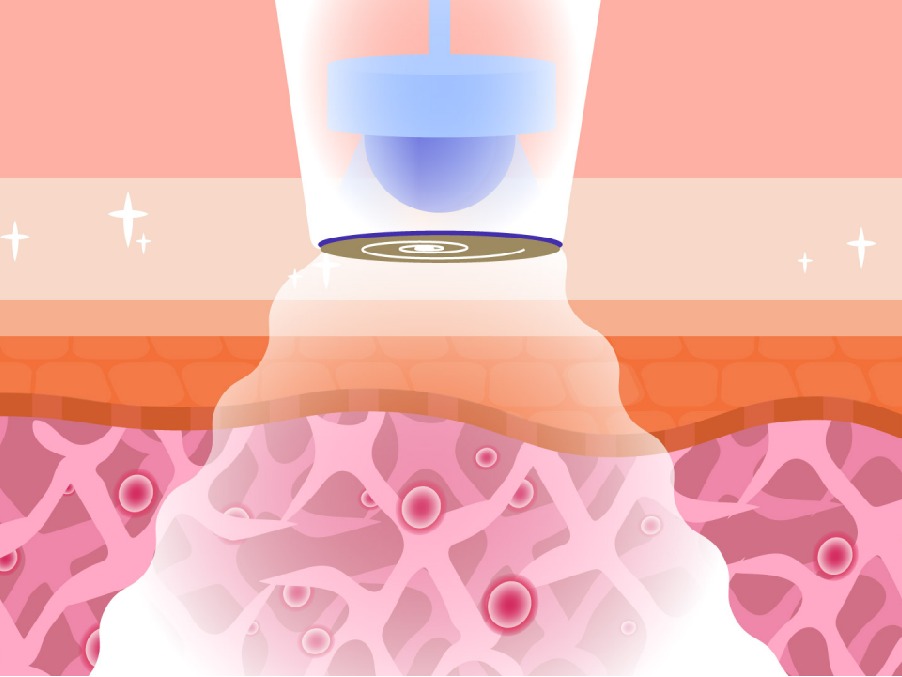 8D水雕美容皮肤企业宣传片MG动画视频-卡多多动漫制作_北京MG动画制作-站酷ZCOOL