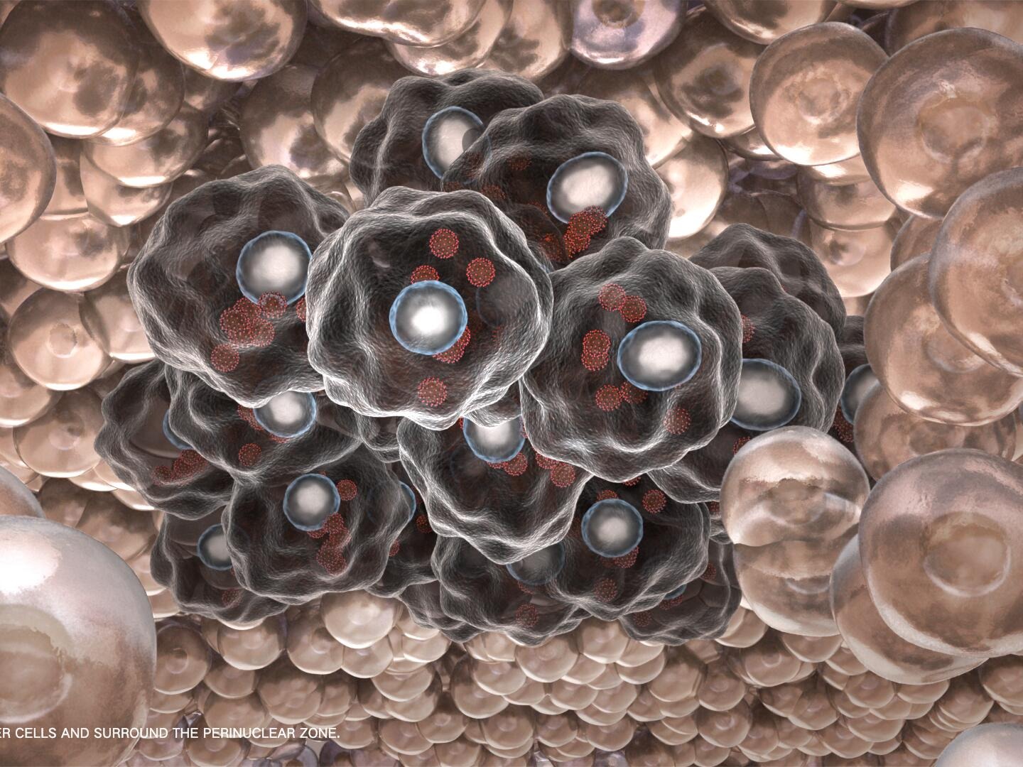 cancer cell_scihua-站酷ZCOOL