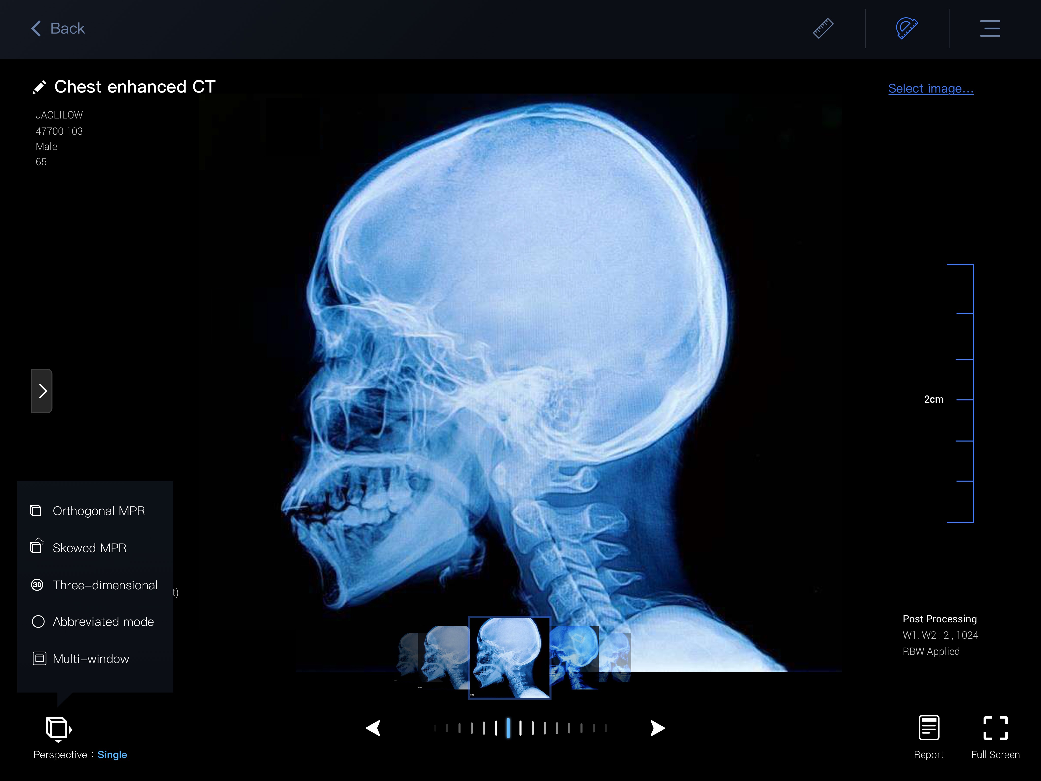 移动影像医疗项目_Mercenart-站酷ZCOOL