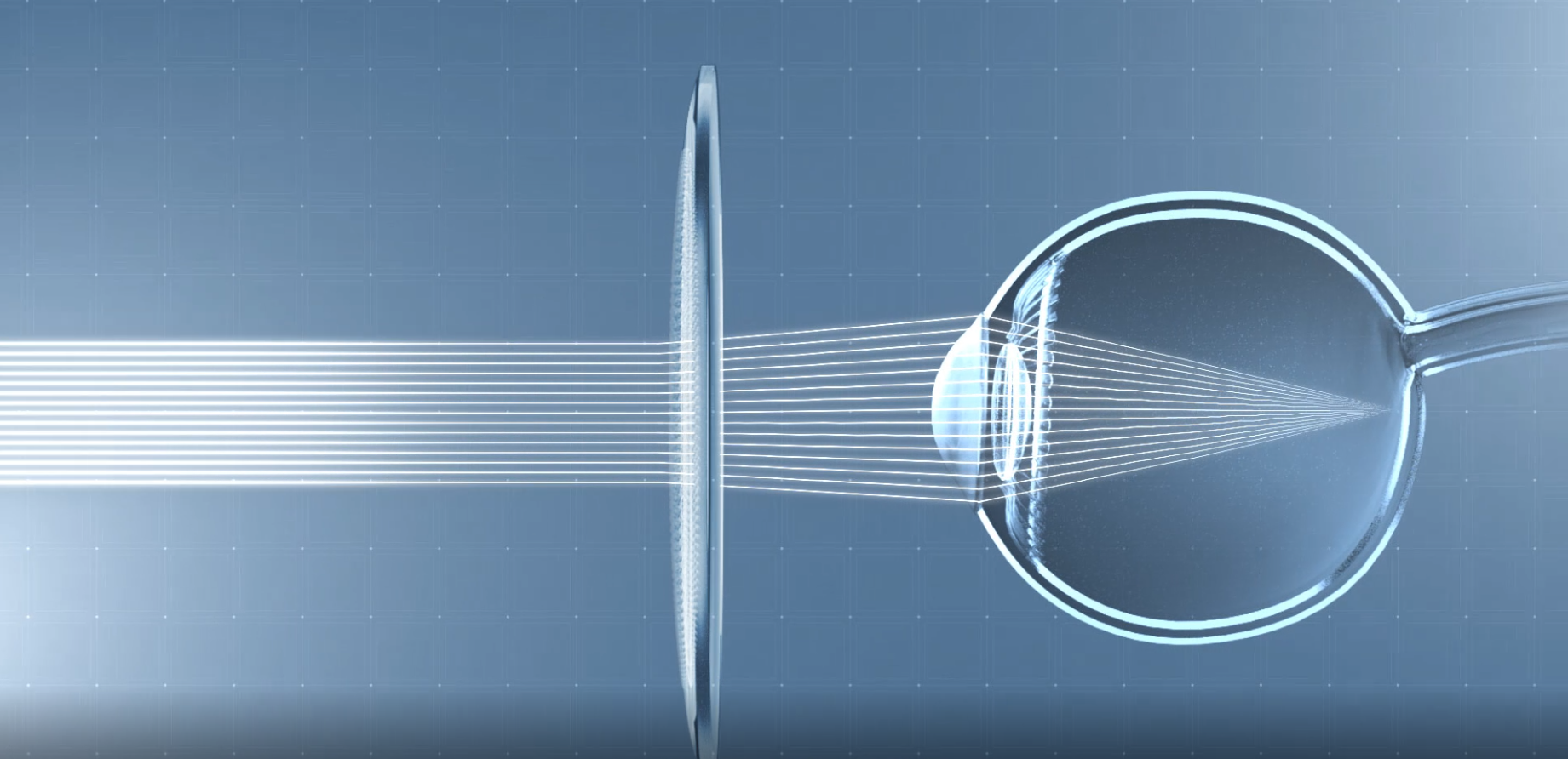 镜片_创意设计作品图片素材-站酷ZCOOL