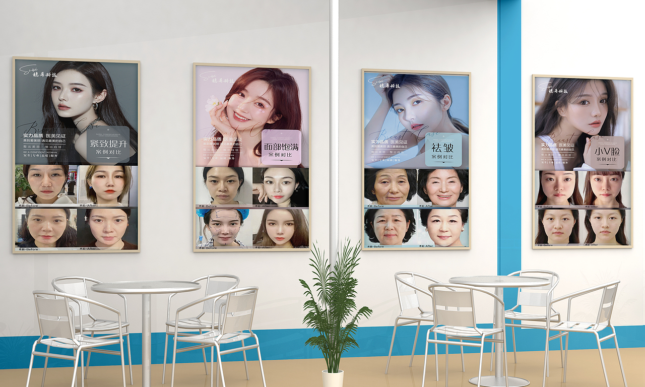 医美案例海报小V脸/填充/提拉_是小圆子呀-站酷ZCOOL