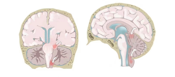 简单的gif相关作品_丫丫阿白1219-站酷ZCOOL