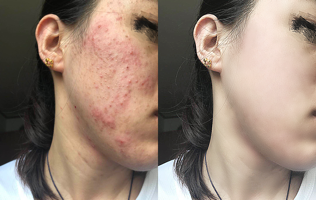 人像磨皮_记住现在-站酷ZCOOL