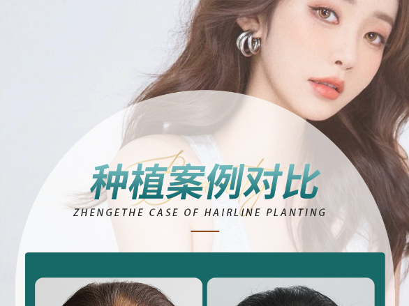植发案例对比_落日余晖lsl-站酷ZCOOL
