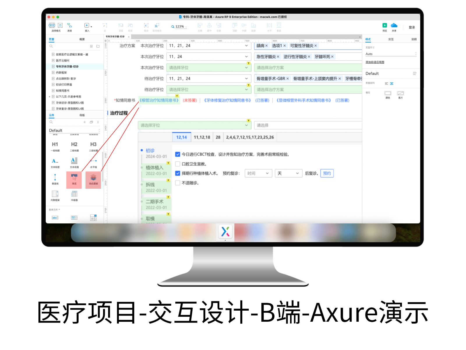 交互设计图-WEB端项目-Axure动态交互图_贝斯特儿-站酷ZCOOL
