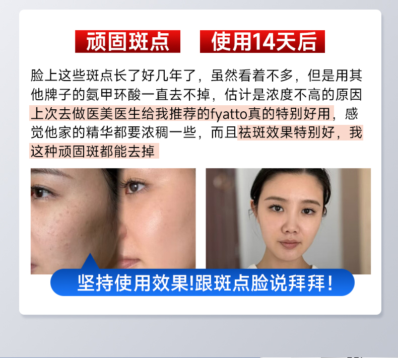 氨甲环酸精华液 | 详情展示_RULU512-站酷ZCOOL