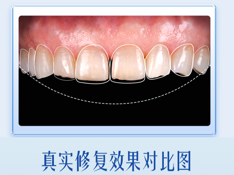 美学贴面_小怪兽547-站酷ZCOOL
